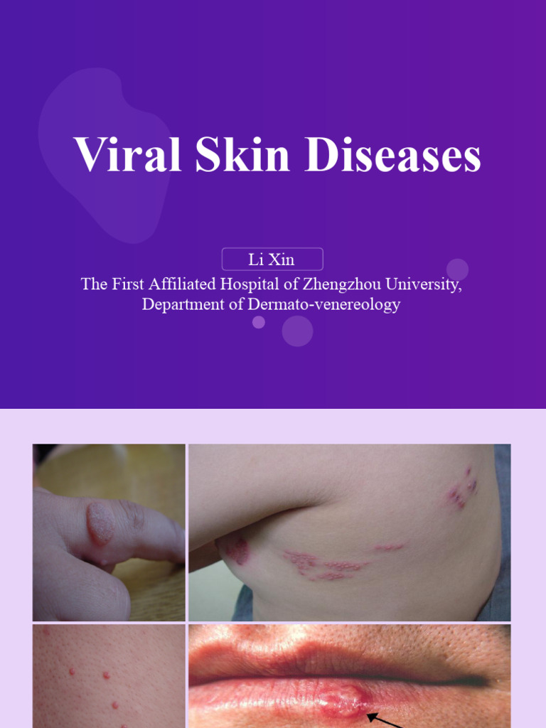 Viral Skin Diseases 2024 | PDF | Virus | Immunology
