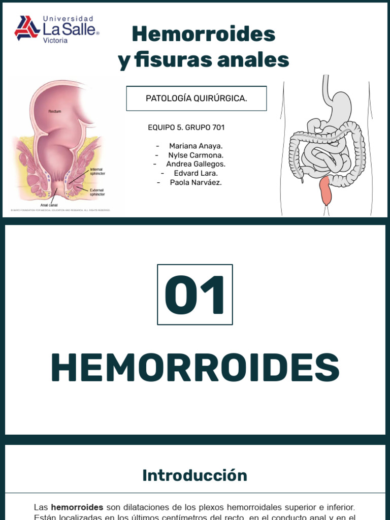 Hemorroides y Fisuras Anales | PDF | Hemorroides | Recto