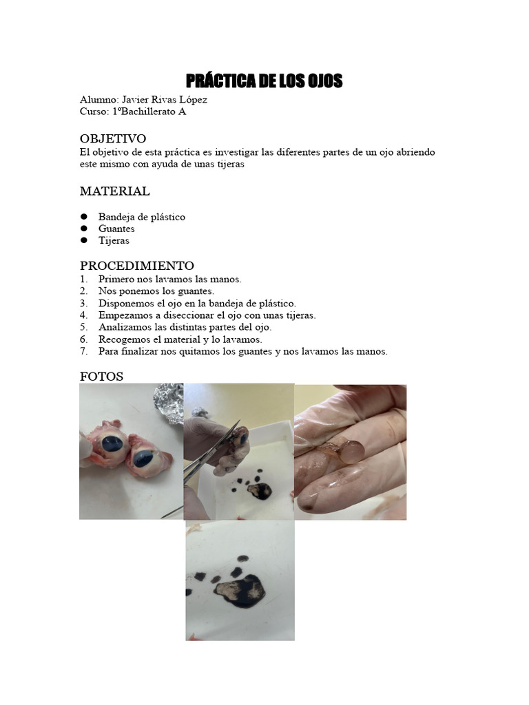 Práctica Ojos | PDF
