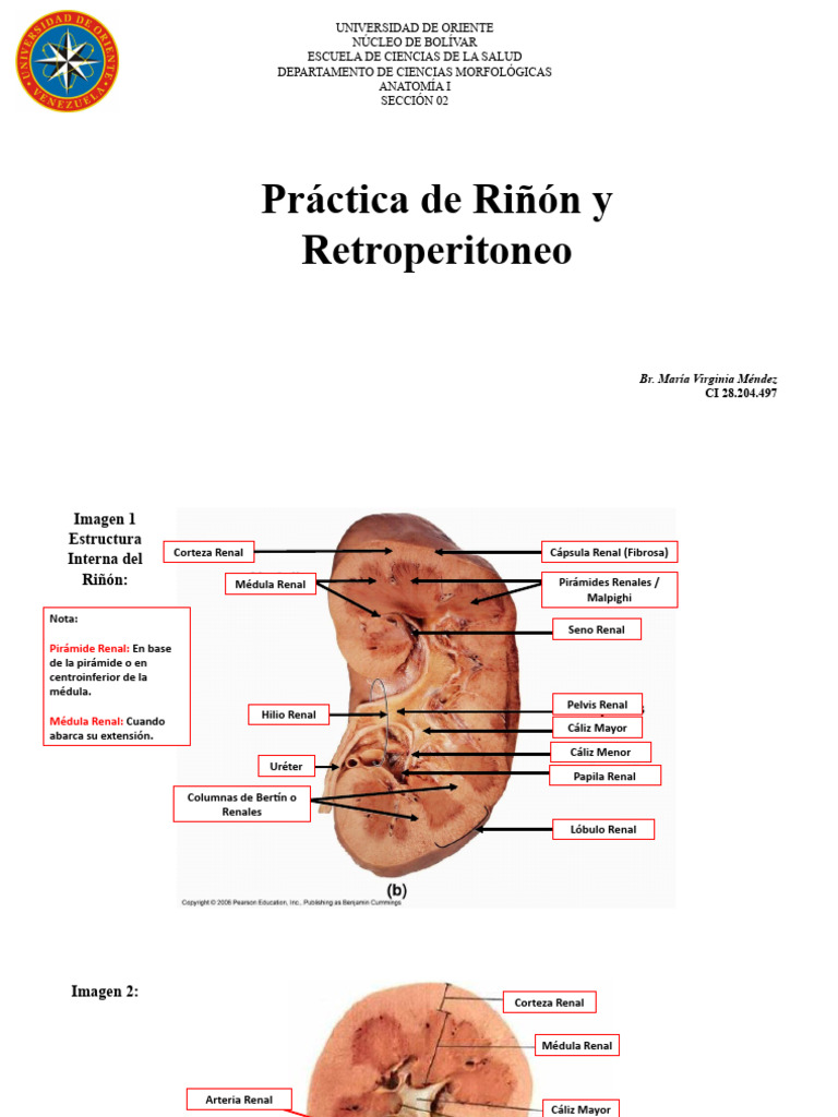 Práctica Riñones y Retroperitoneo | PDF | Riñón | Abdomen