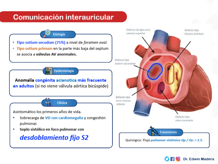 Comunicación Interauricular | PDF