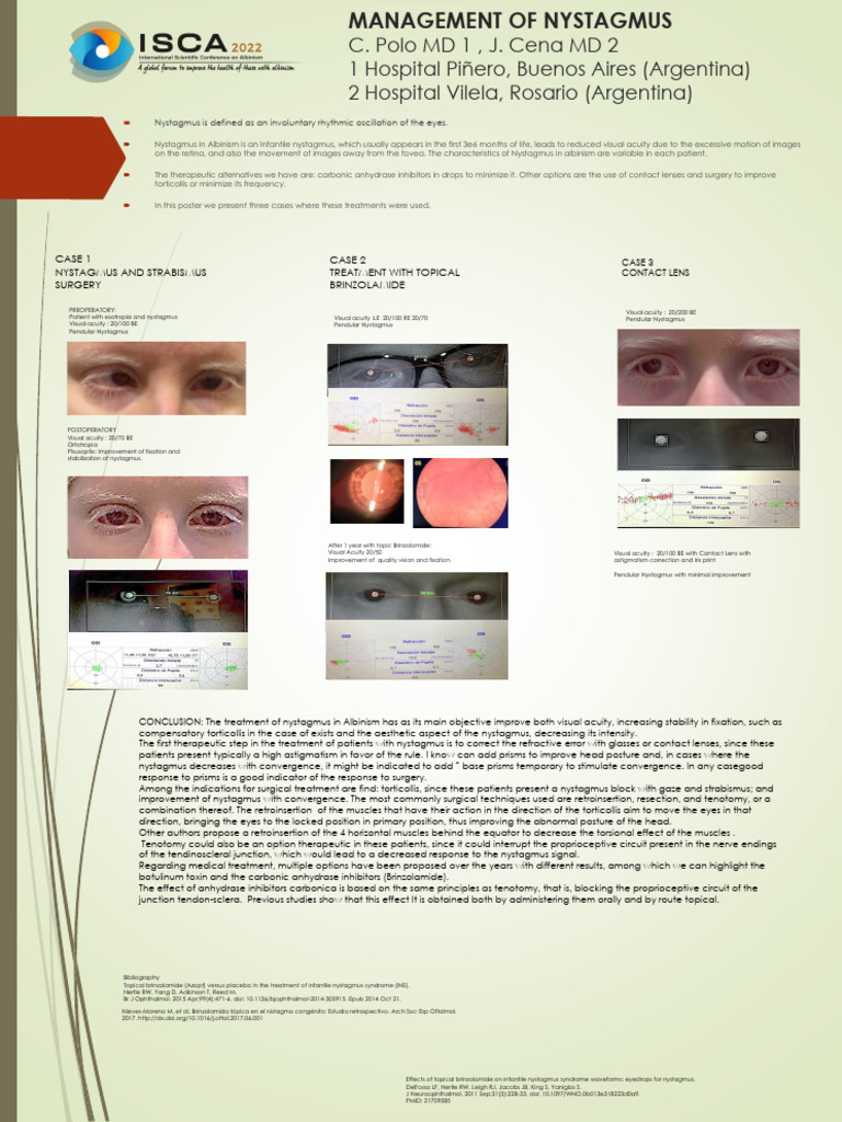 Polo-Poster-ISCA_2022 | PDF | Visual Acuity | Contact Lens