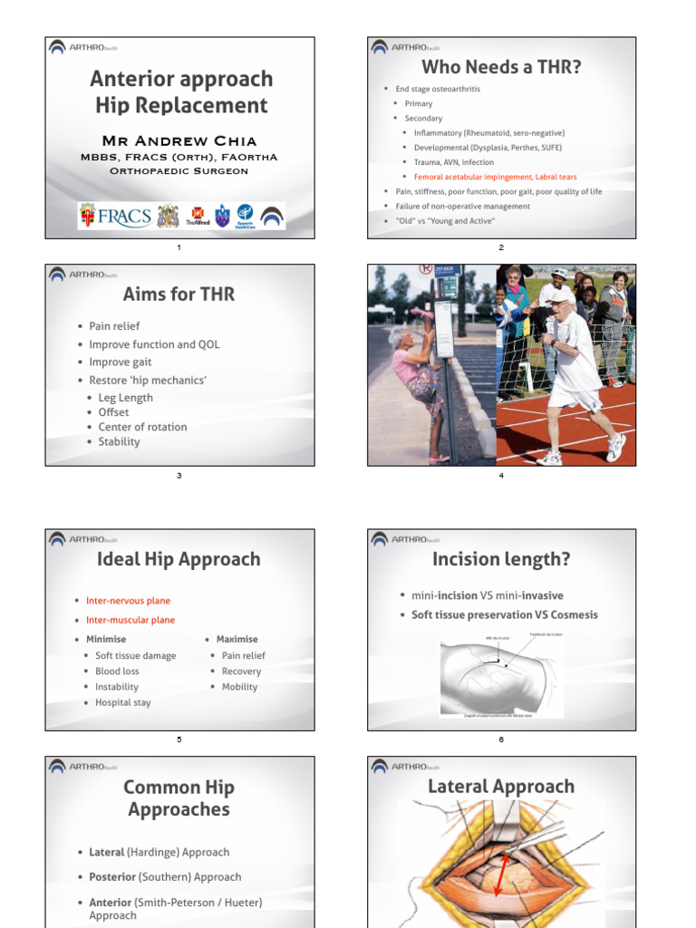 Anterior THR and Hip Arthros | PDF | Diseases And Disorders | Surgery