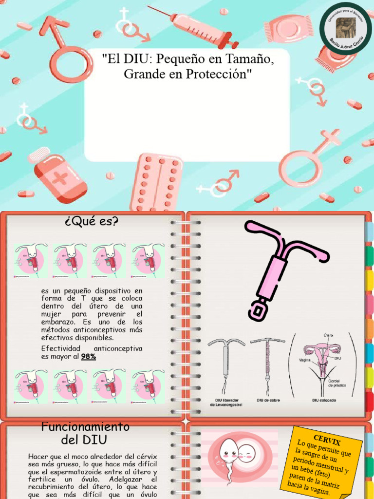 Método Anticonceptivo DIU | PDF | Control de la natalidad ...
