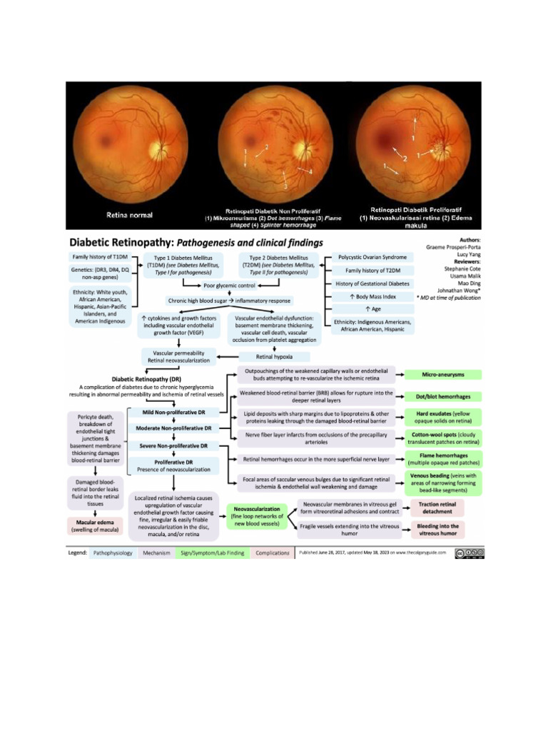Print PBL Mata PDR NPDR | PDF