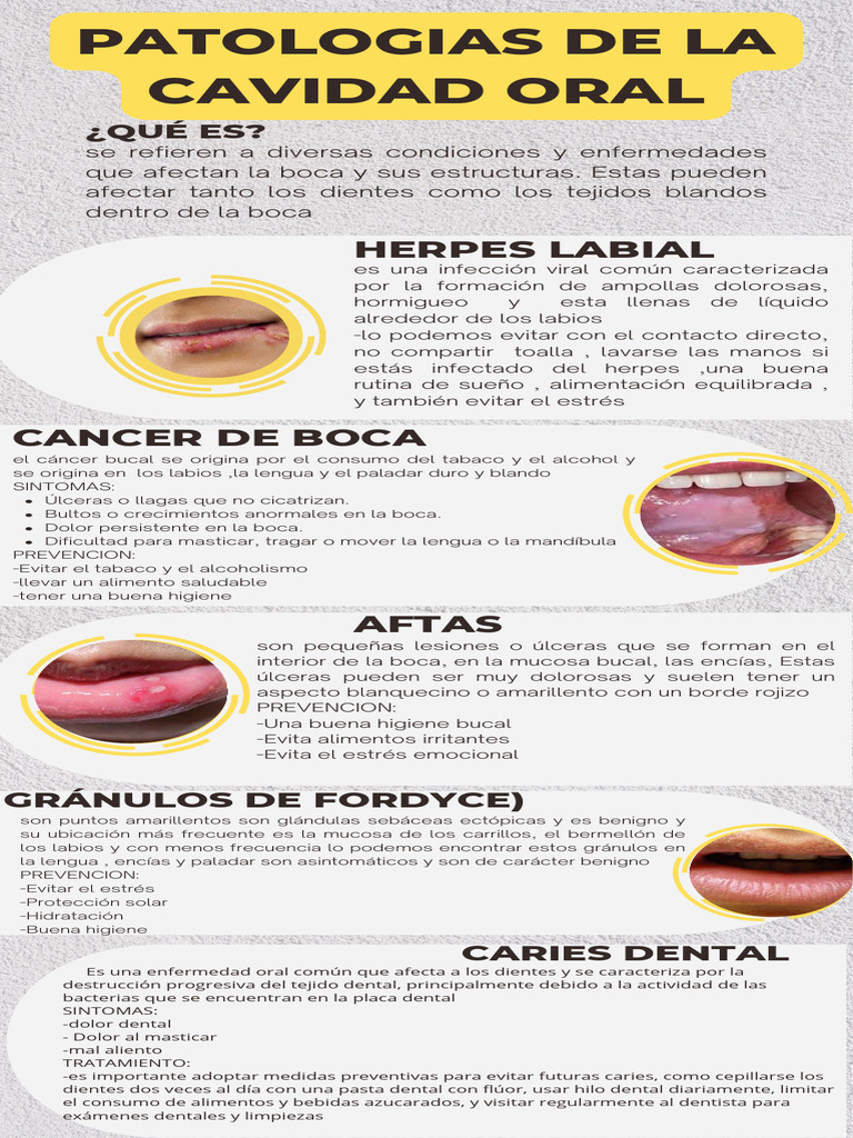 Infografia de Patologia de Cavidad Oral | Descargar gratis PDF | Boca | Odontología