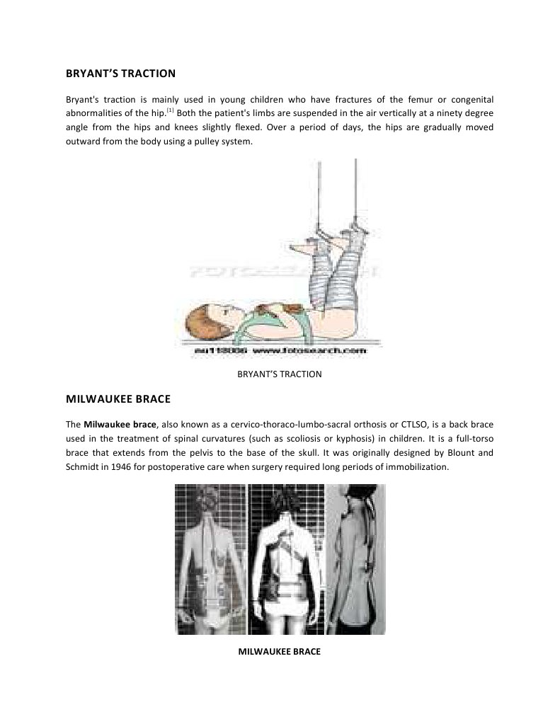 Types of Traction and Casting Methods Used in Bone and Joint Injuries ...