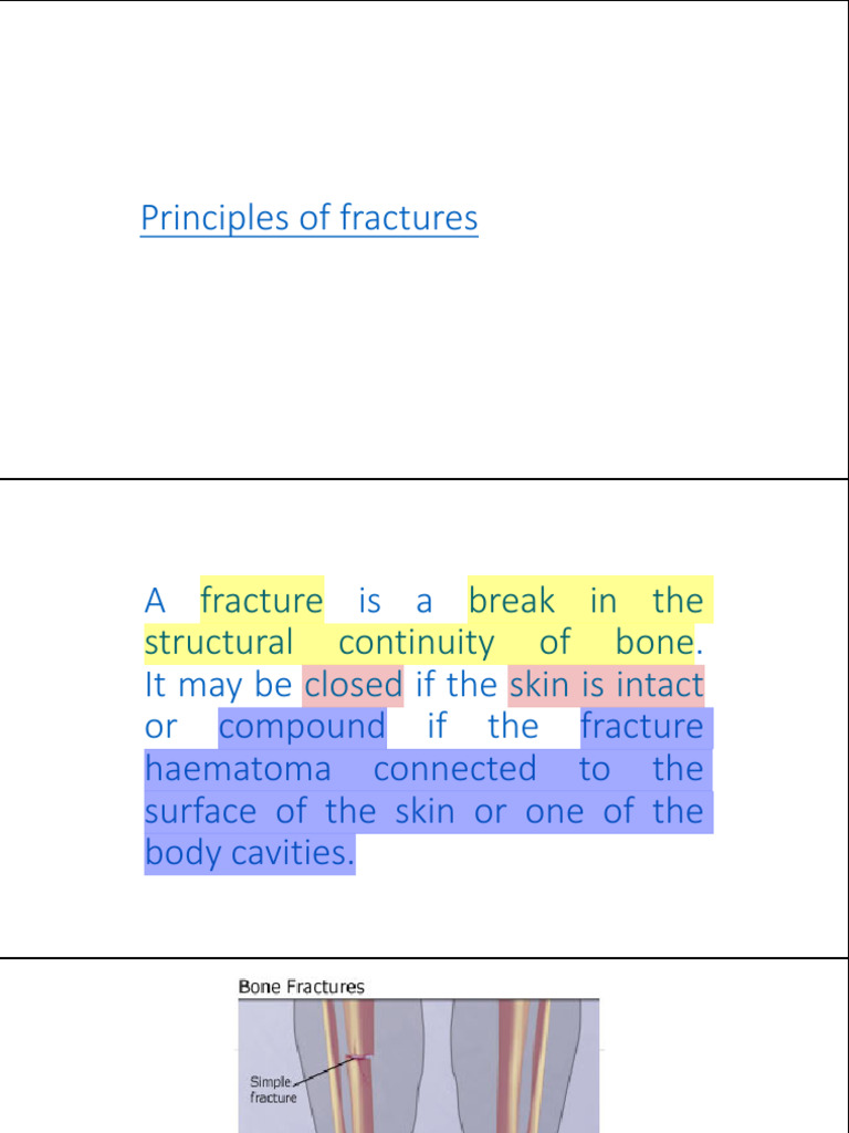 Types and Treatment of Bone Fractures | PDF | Bone | Musculoskeletal System