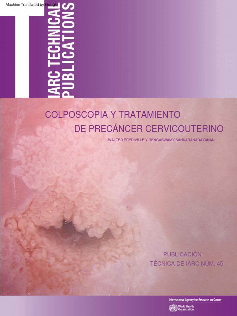 Colposcopia y tratamiento del precáncer cervical | PDF | Cáncer de ...