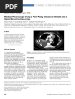 Medtronic - CONCERTO - Embolization Coils | PDF | Helix | Materials