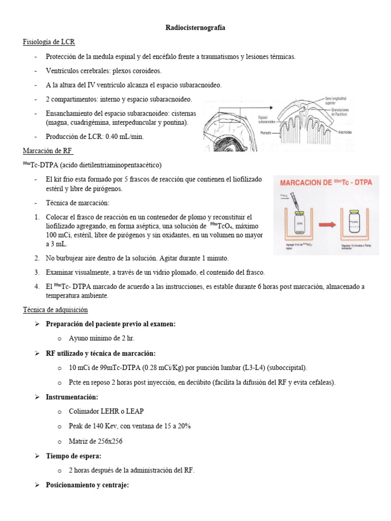 Radiocisternografia | PDF | Fluido cerebroespinal | Neurología