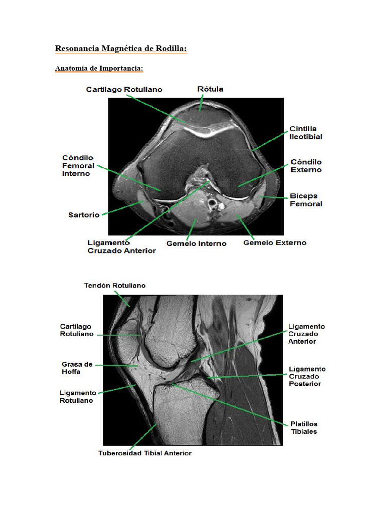 RM Rodilla | PDF | Rodilla | Articulaciones