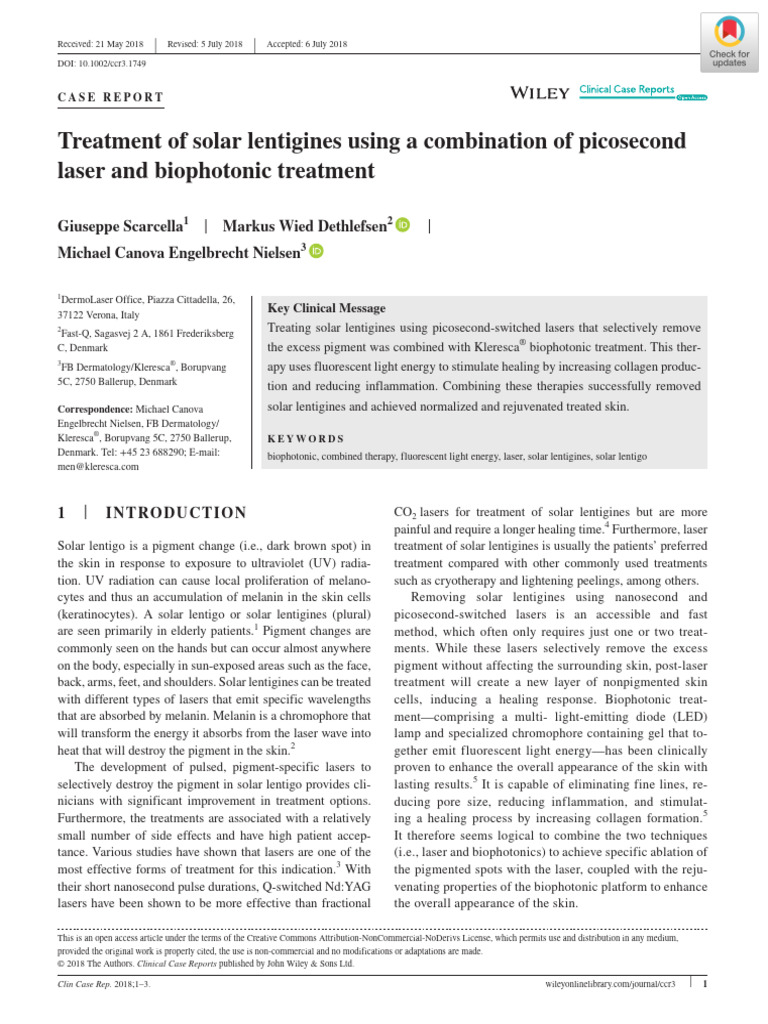 Treatment of Solar Lentigines Using A Combination | PDF | Laser | Optics