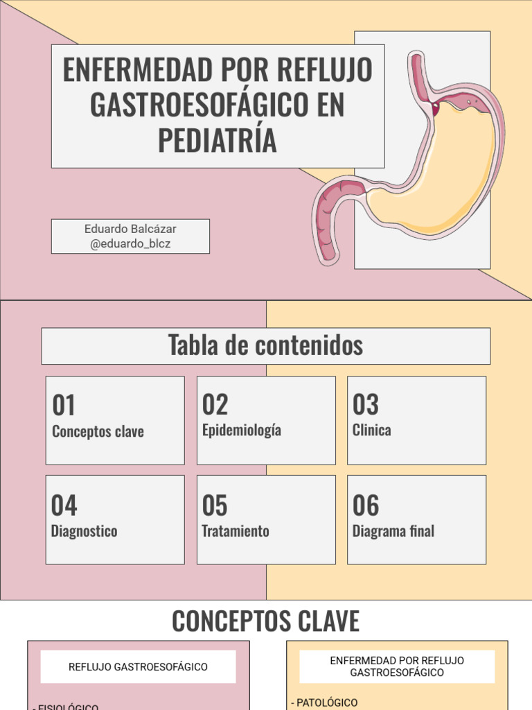 Erge en Pediatria - Hep | PDF | La enfermedad por reflujo ...