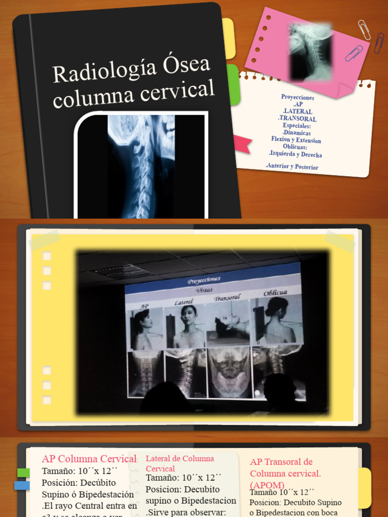 RX Columna Cervical | Descargar gratis PDF | La columna vertebral | Sistema esquelético