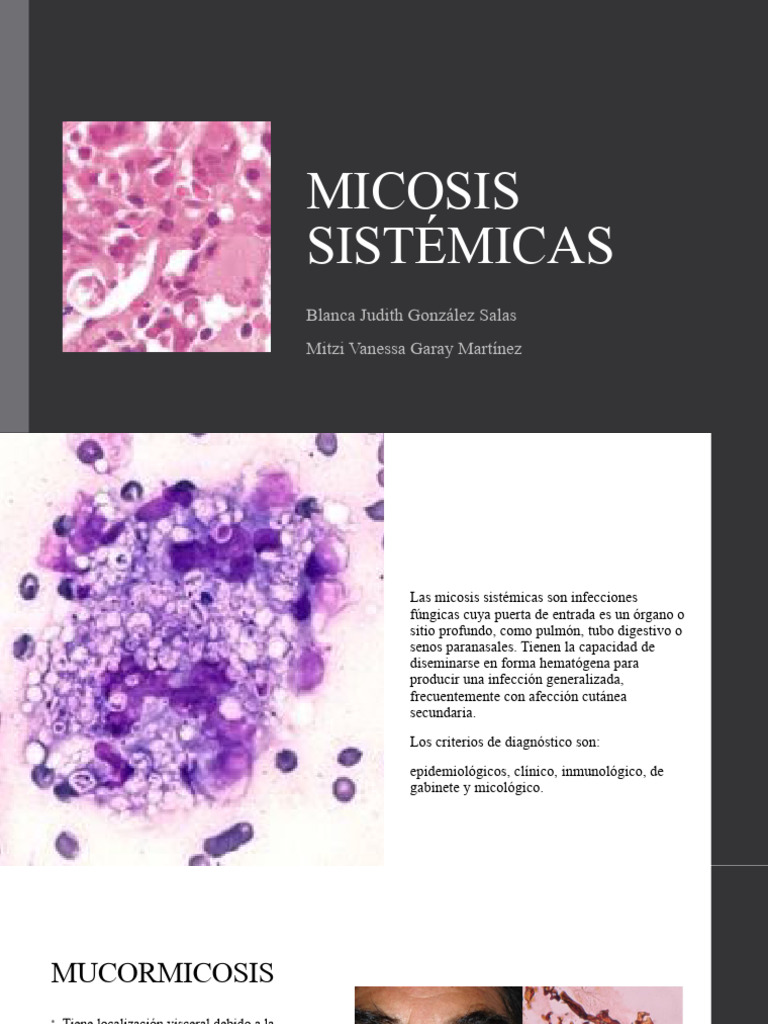 Micosis Sistémicas.. | PDF | Causas de la muerte | Inmunología