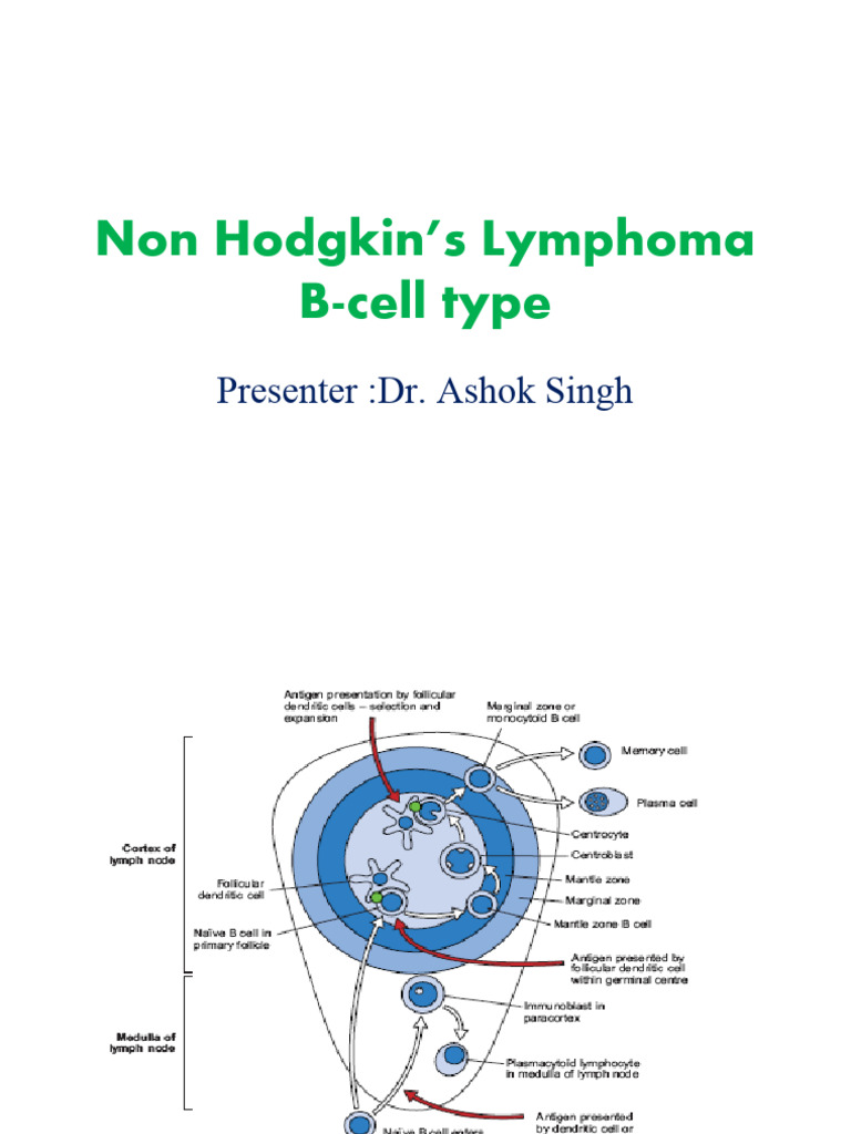 Ashok NHL | PDF | Lymphoma | B Cell