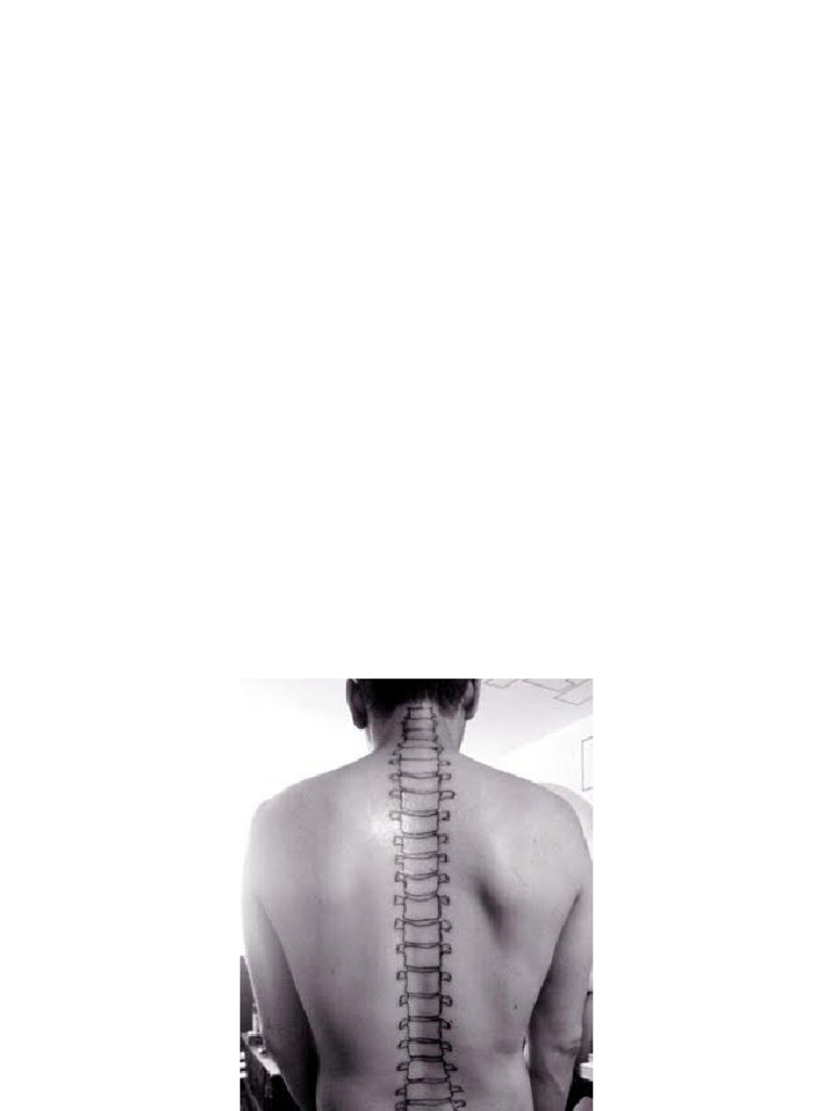Vertebral Column Pathologies | PDF | Vertebral Column | Vertebra