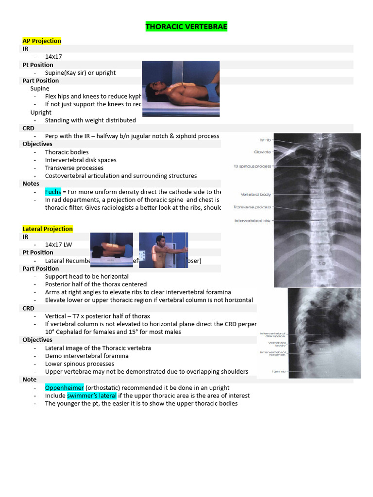 Thoracic Vertebrae | Download Free PDF | Thorax | Vertebra