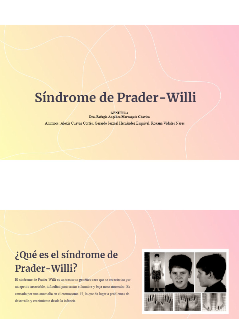 Síndrome de Prader-Willi: Características y Tratamiento | PDF | Gene ...
