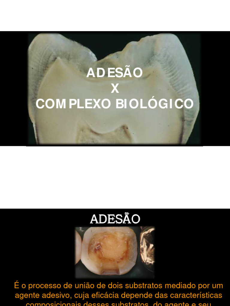 Adesão X Complexo Biológico 2 | PDF | Dentina | Esmalte dentário