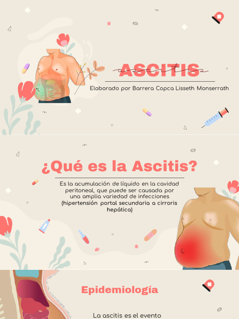ASCITIS | PDF | Especialidades Medicas | Medicina CLINICA