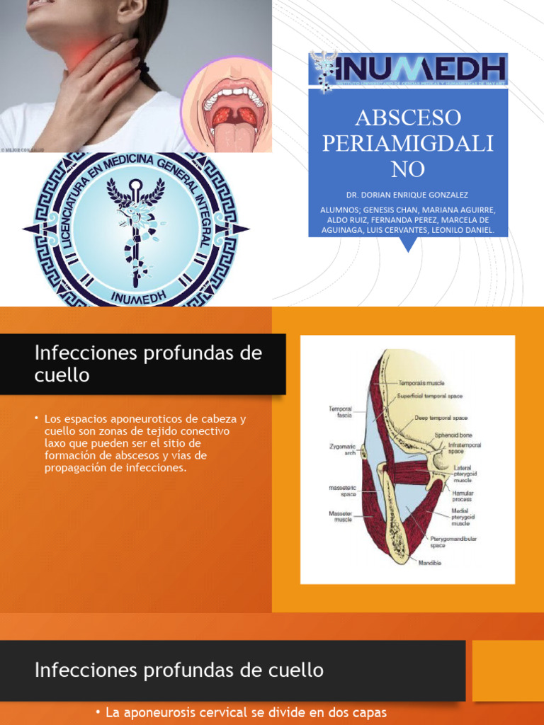 ABSCESO PERIAMIGDALINO | PDF | Estreptococo | Neumonía