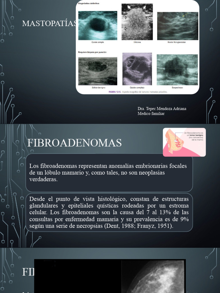 MASTOPATIAS | PDF | Cáncer | Pecho