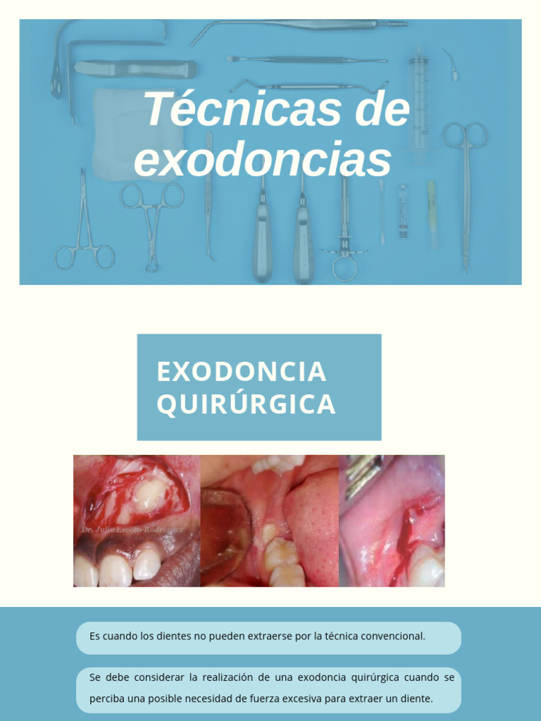 Técnicas de Exodoncias | PDF | Diente | Boca