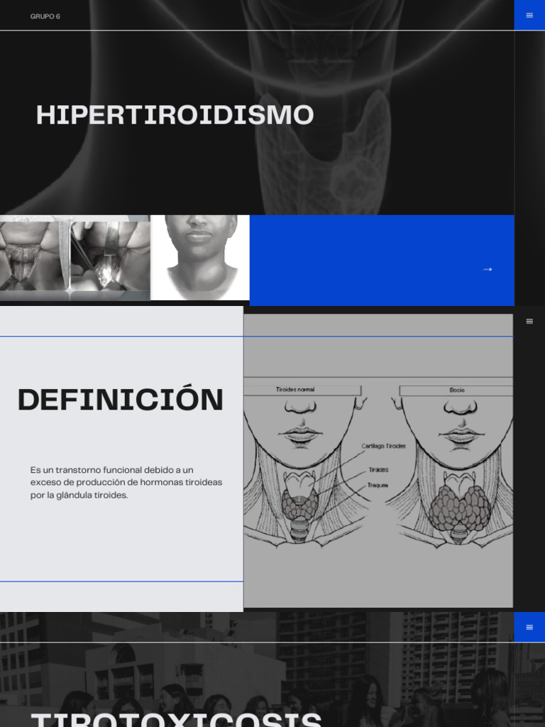 HIPERTIROIDISMO - Cuidados de Enfermería Según Los Niveles de Prevención | PDF | Hipertiroidismo ...