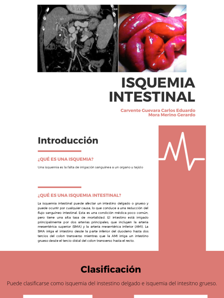 Isquemia Intestinal | PDF | Isquemia | Tracto gastrointestinal