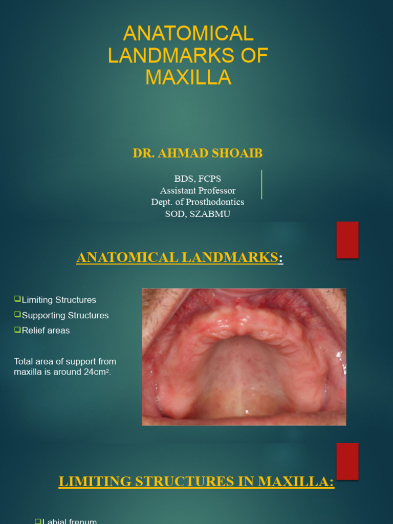 Maxillary Anatomy for Denture Design | PDF | Dentures | Tooth
