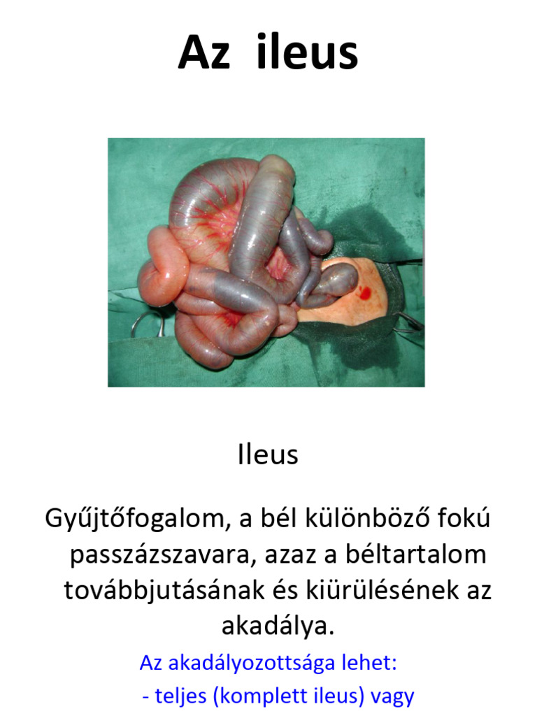 Ileus | PDF
