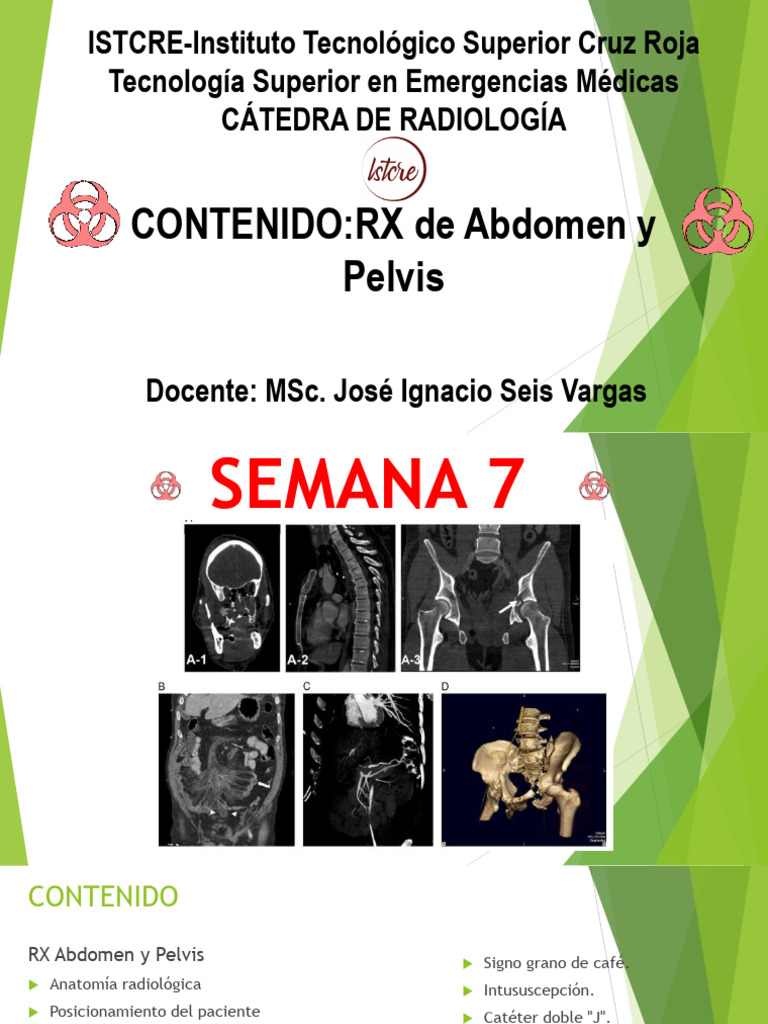 Semana 7. | PDF | Abdomen | Sistema digestivo humano