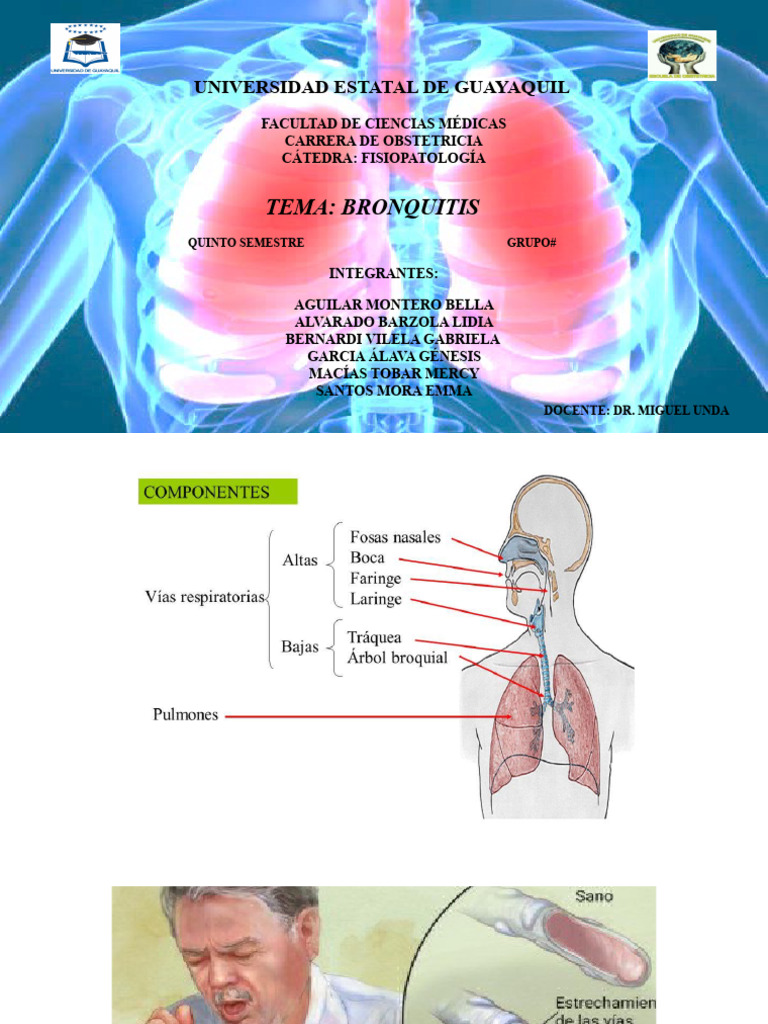 2 BRONQUITIS | PDF | Bronquitis | Tos