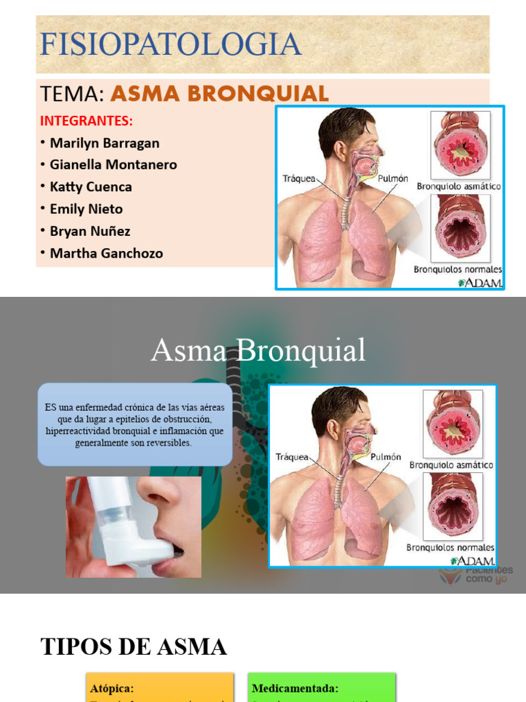 Fisiopatología del Asma Bronquial | PDF | Asma | Alergia