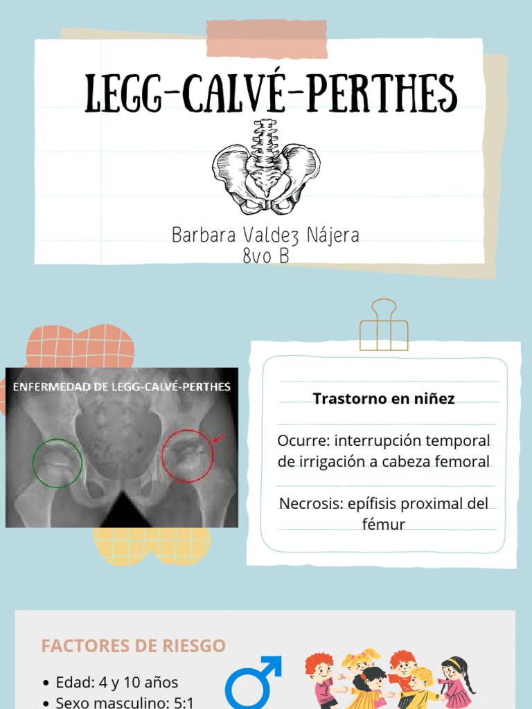 Legg-Calvé-Perthes | PDF | Anatomía del miembro inferior | Sistema ...