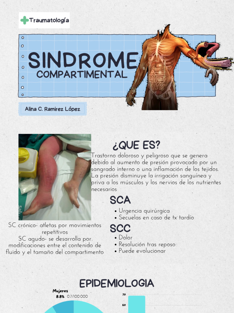 Sindrome Compartimental | PDF | Tejido suave | Anatomía humana