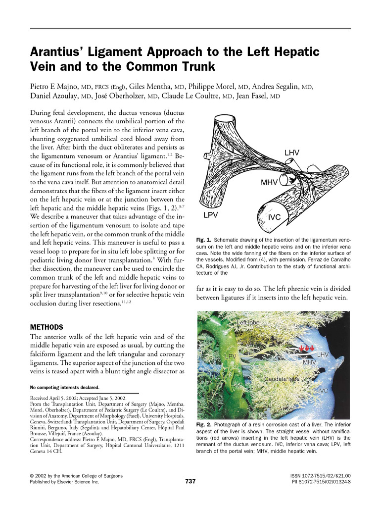 Arantius' Ligament Approach To The Left Hepatic Vein and To The Common ...
