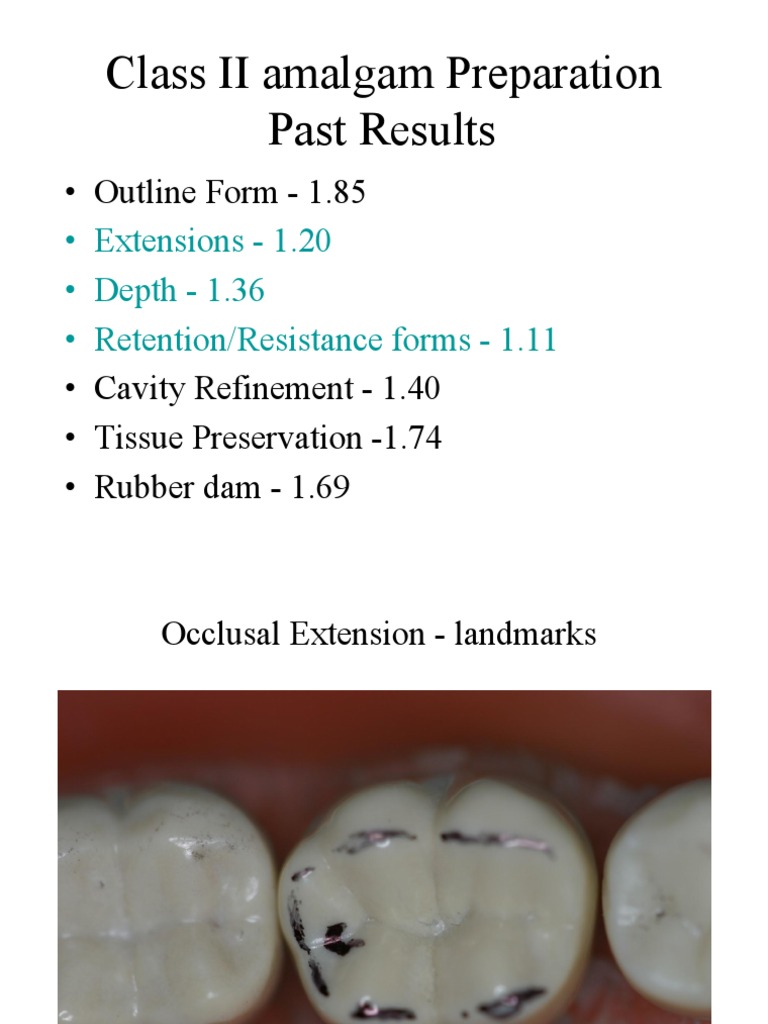 Class II Amalgam Preparation Past Results: - Outline Form - 1.85 | PDF
