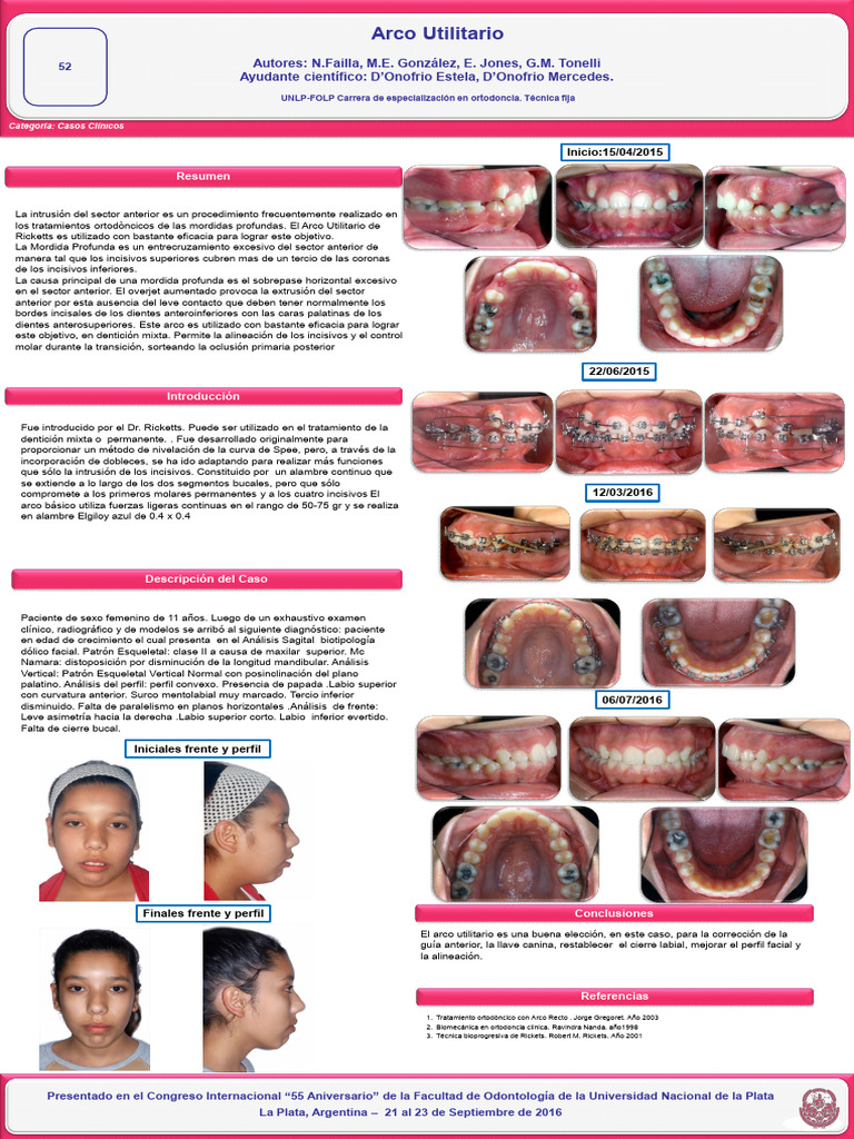 Arco Utilitario | PDF | Ortodoncia | Odontología