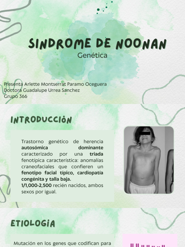 Sindrome Noonan | PDF | Causas de la muerte | Enfermedades y trastornos humanos