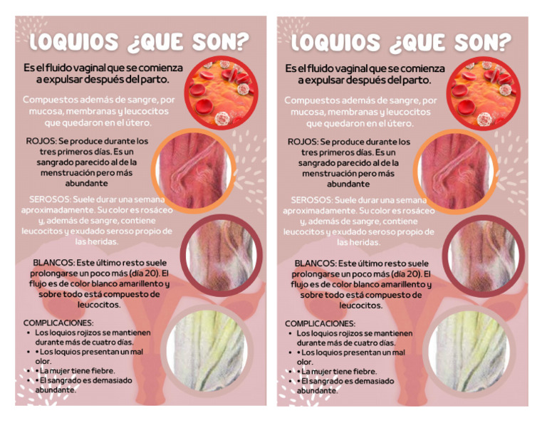 Flyer Loquios | PDF