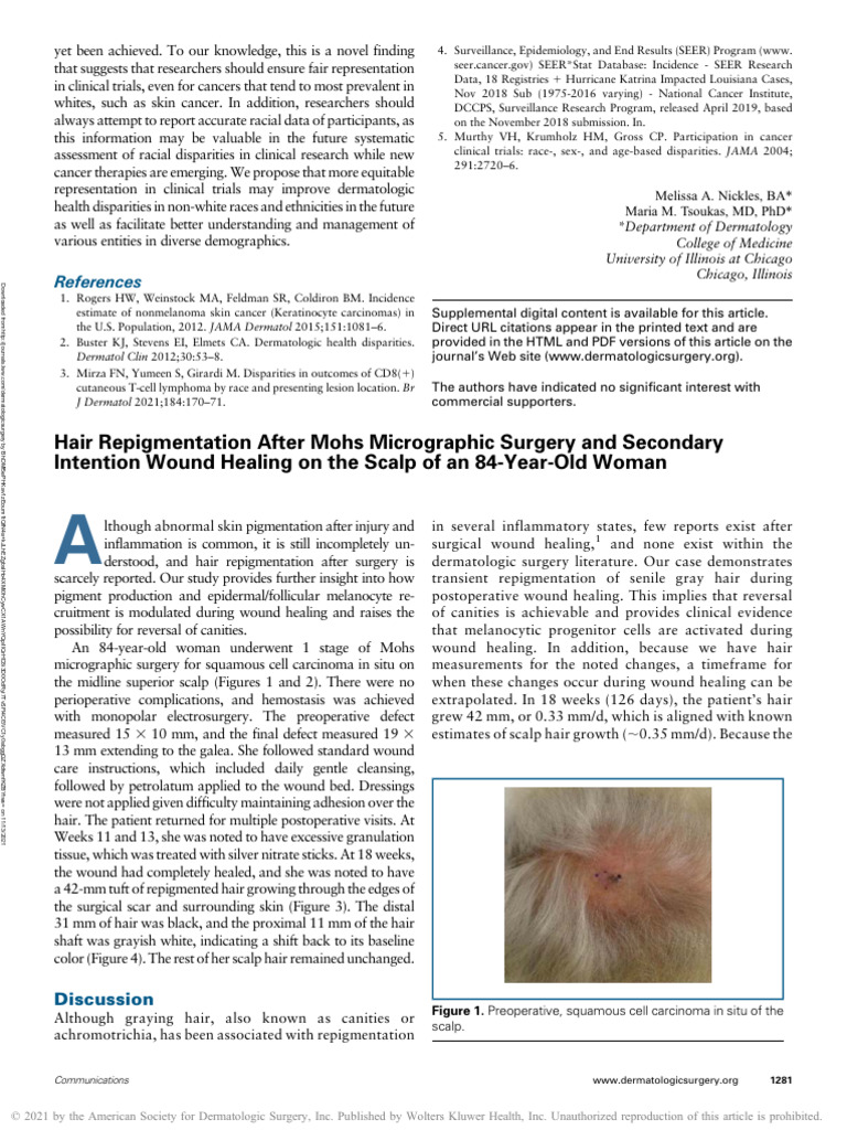 Hair Repigmentation After Mohs Micrographic.26 | PDF | Reactive Oxygen Species | Medical Specialties