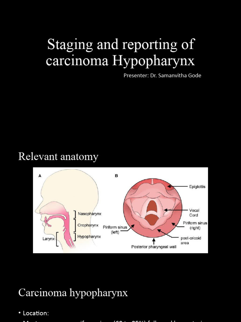 Hypopharynx Cancer Staging Overview | PDF | Anatomy | Human Head And Neck