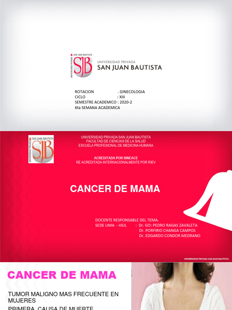 16 PPT Cancer de Mama | PDF | Cáncer de mama | Cáncer