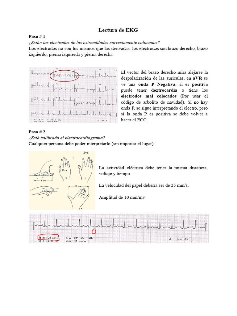 Lectura de EKG | PDF | Electrocardiografia | Sistema cardiovascular