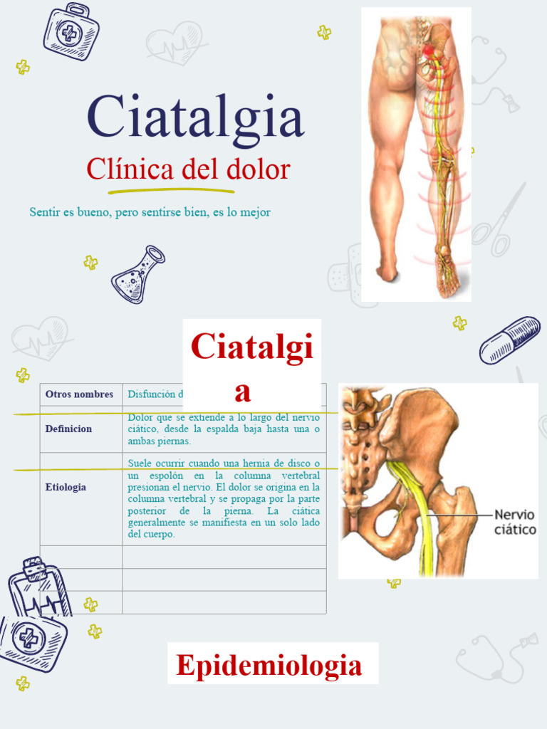 Tratamiento y definición de ciatalgia | PDF | Salud y bienestar