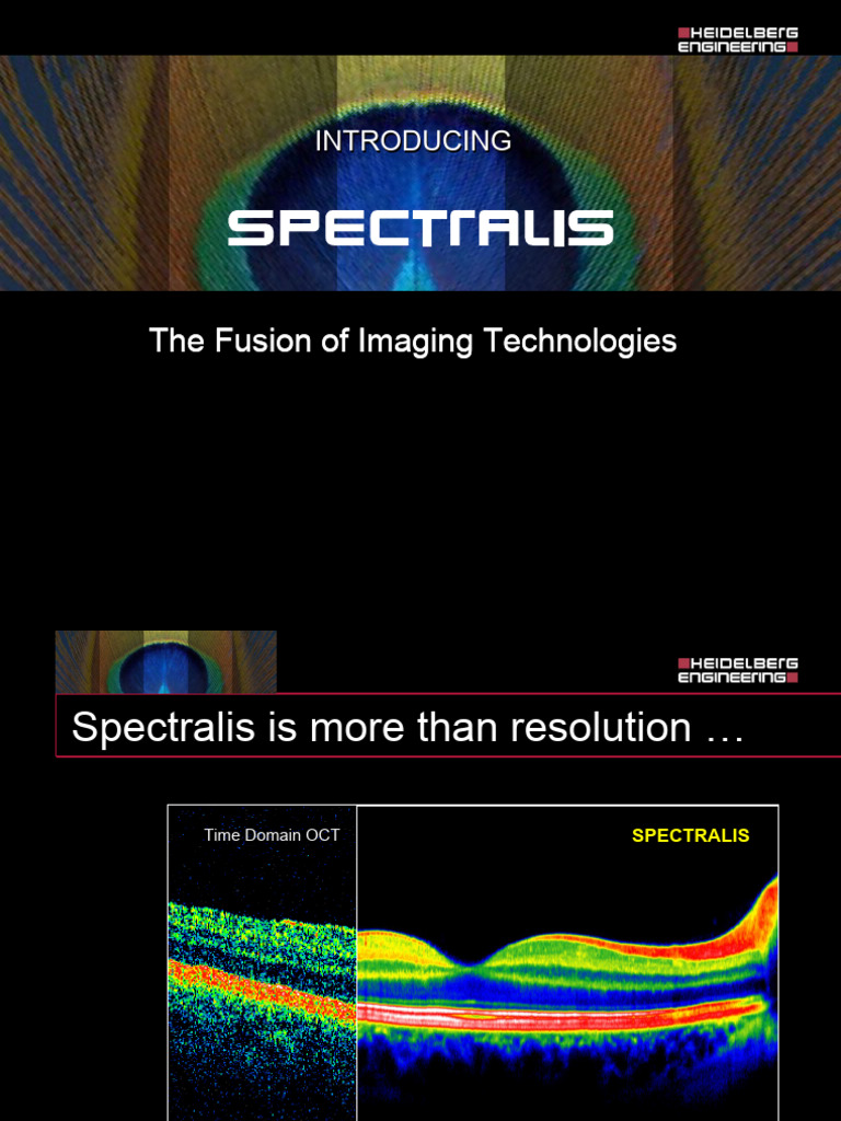 Spectralis English Product Presentation | PDF | Imaging | Vision