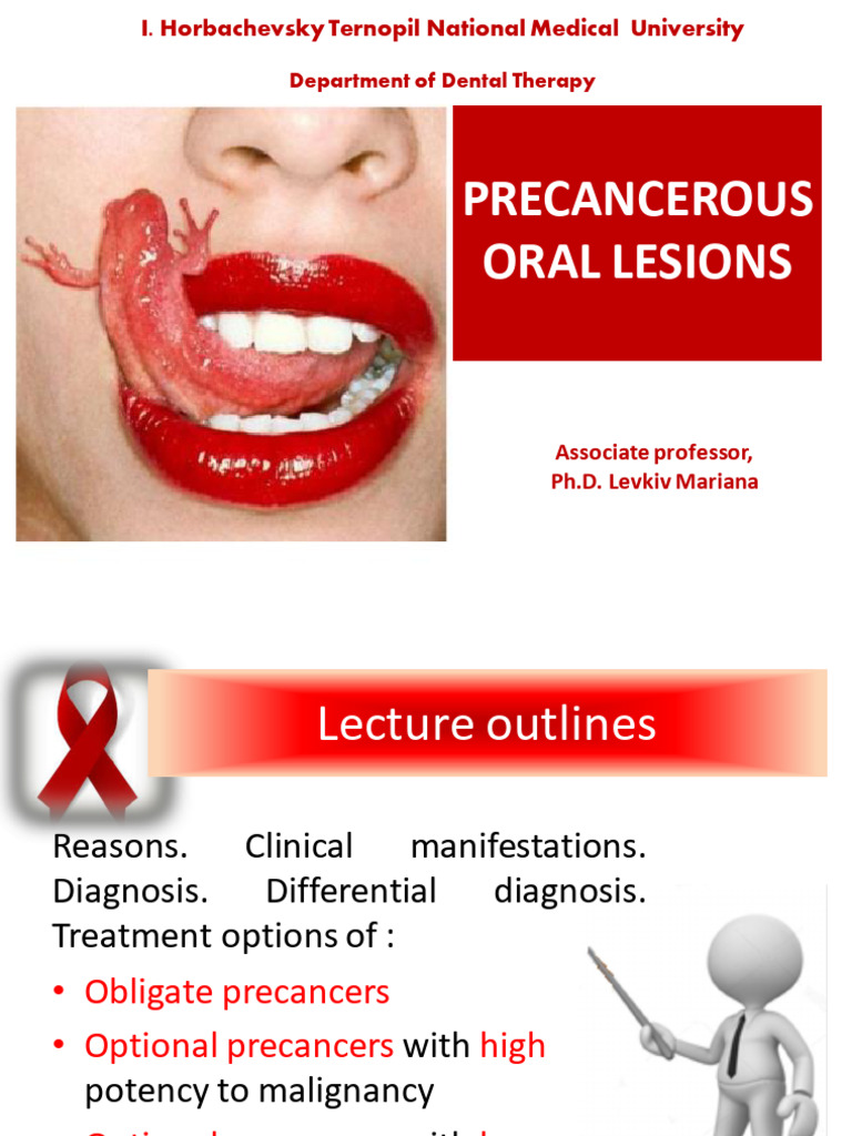 Precancerous Lesions of Oral Cavity | Download Free PDF | Diseases And ...